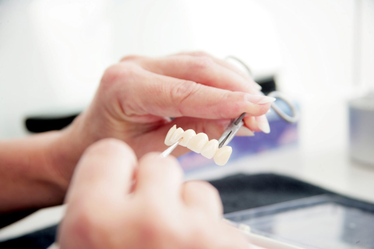 Tooth Bridge Dentist in Canton OH - Fixed Dental Bridge